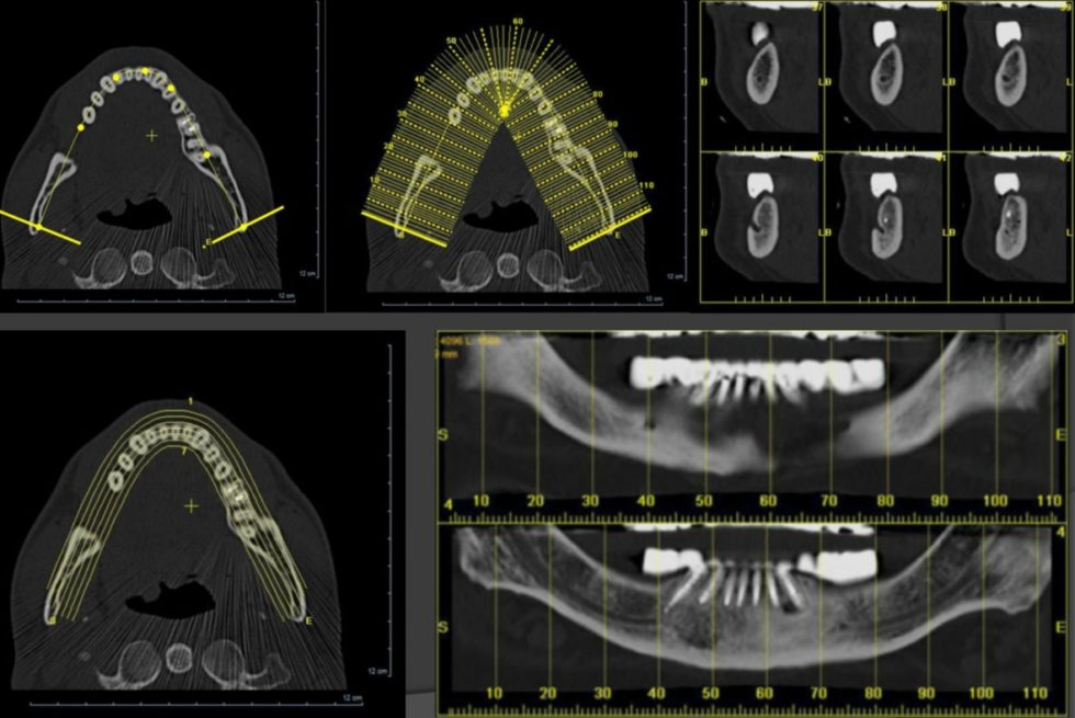 Dentascanner - Coradix