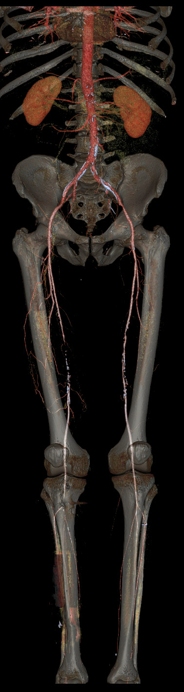 Scanner sans ou avec injection - Coradix